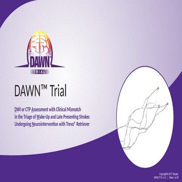Dawn Trial for acute ischemic stroke presentation | PPTX
