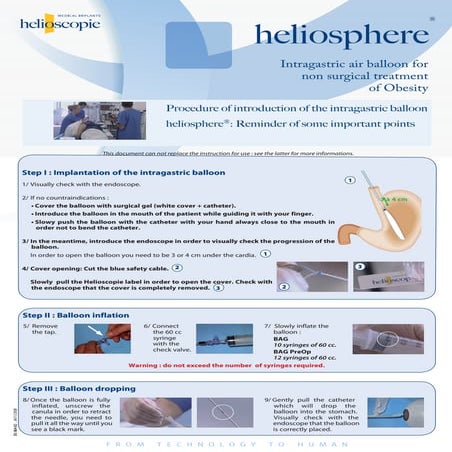 Heliosphere Intragastric Balloon | PDF