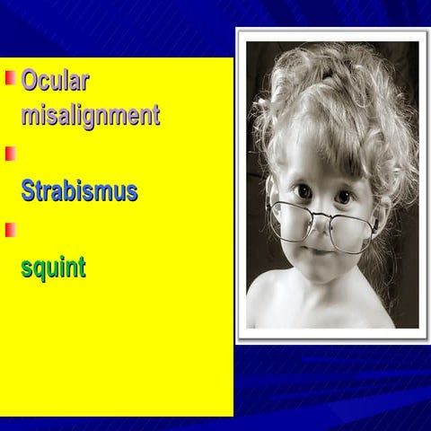 ophthalmology.squint.(dr.khald) | PPT