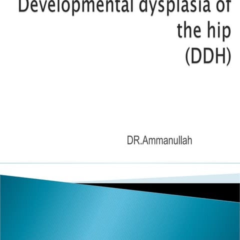 DDH | PPT