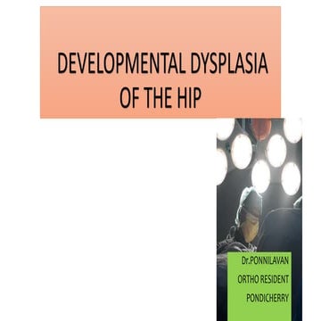 Splints in DDH | PDF