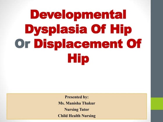 Congenital Dislocation of the Hip - PHYSIOTHERAPY | PPT