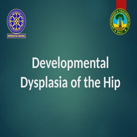 developmental dysplasia of the hip or DDH.pptx
