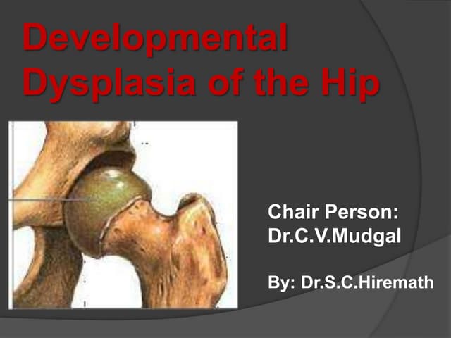Developmental dysplasia of the hip | PPTX