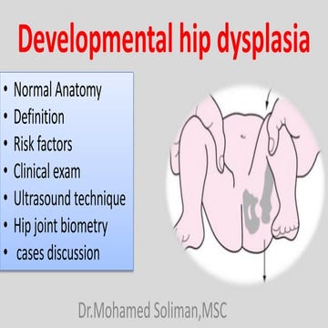 Ultrasound of Developmental dysplasia of hip Joint ..Dr.Mohamed Soliman | PDF