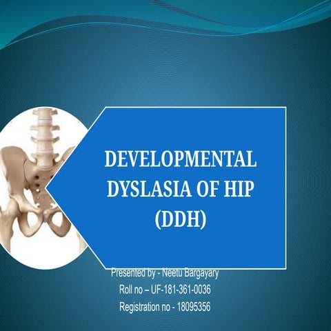 Developmental Dysplasia of Hip (DDH) or Congenital Dislocation of Hip ...