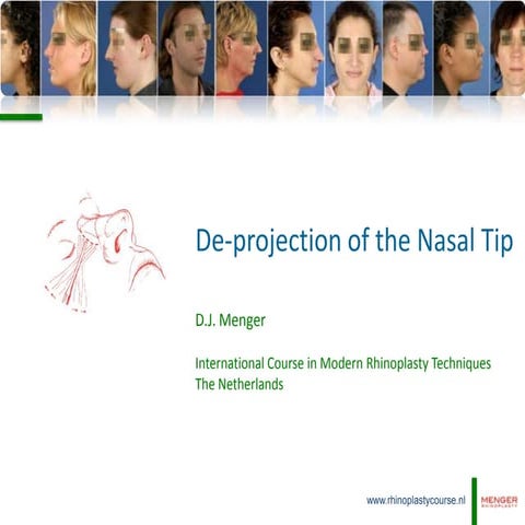 De-projection of the nasal tip | PPTX