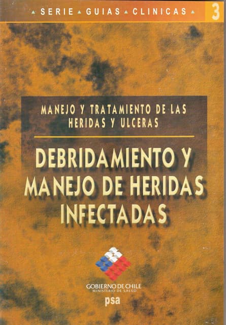 Lineas De Tension De Langer | PDF
