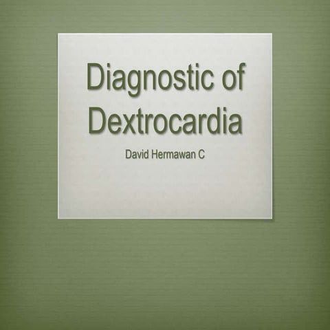 Dextrocardia | PPTX