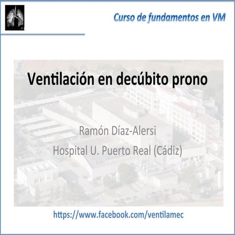 DECUBITO PRONO EN SINDROME DE DISTRES RESPIRATORIO AGUDO | PPTX