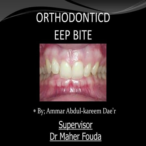 orthodontic deep bite | PPT