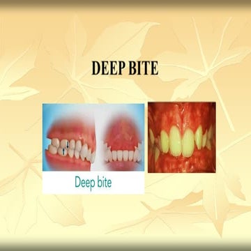 Deep bite.pptx over bite Deep bite.pptx over bite | PPTX