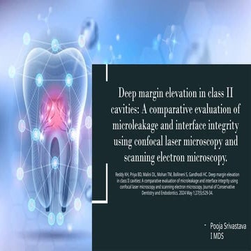 Deep Margin Elevation In Class Ii Cavities Pptx