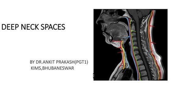 Neck Spaces Ct Anatomy NECK SPACES AND ANATOMY Ppt Download