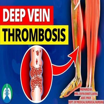 Comprehensive Guide to Prevention and Treatment of Deep Vein Thrombosis ...