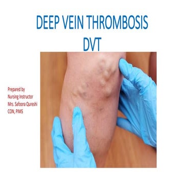Homan’s Sign for DVT.pptx