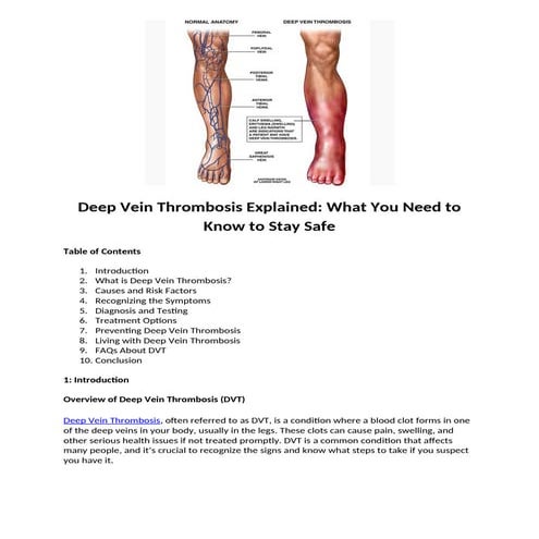 Deep Vein Thrombosis Explained - What You Need to Know to Stay Safe.pdf