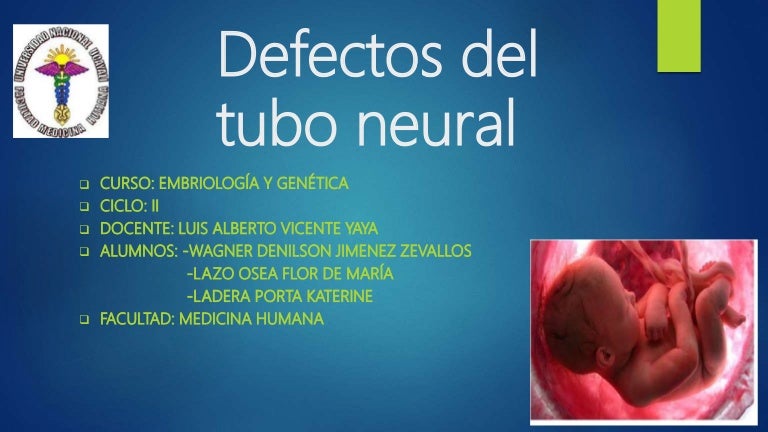 Defectos del-tubo-neural