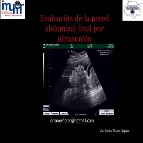Defectos de la pared abdominal fetal.ppt para slsh | PDF