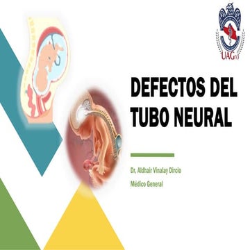 Defectos del tubo neural Pediatría..pptx
