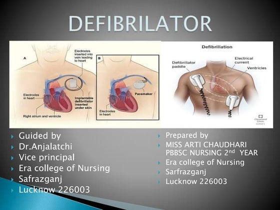 Cardiac monitor ppt | PPTX | Heart and Cardiovascular Diseases ...