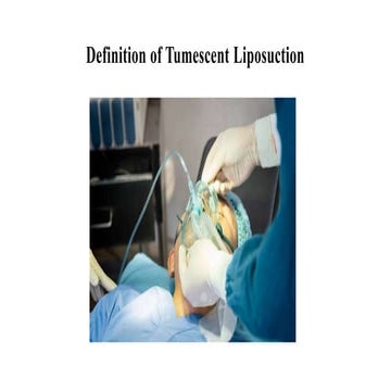 Definition of tumescent liposuction | PPTX