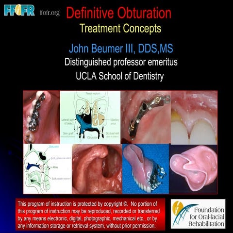 Definitive obturation treatment concepts | PPT