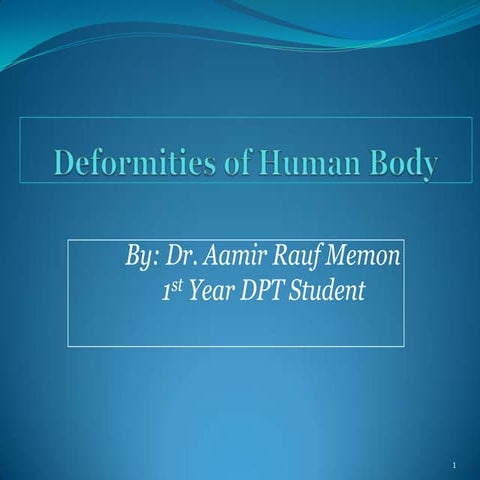 Deformities Of Human Body | PPTX