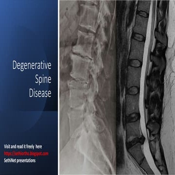 Abcs of the degenerative spine | PDF