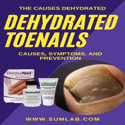 What causes dehydrated toenails and how can you prevent them? | PDF