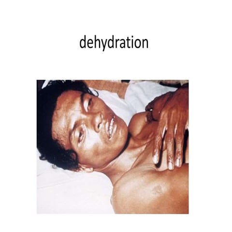 Dehydration | PPTX