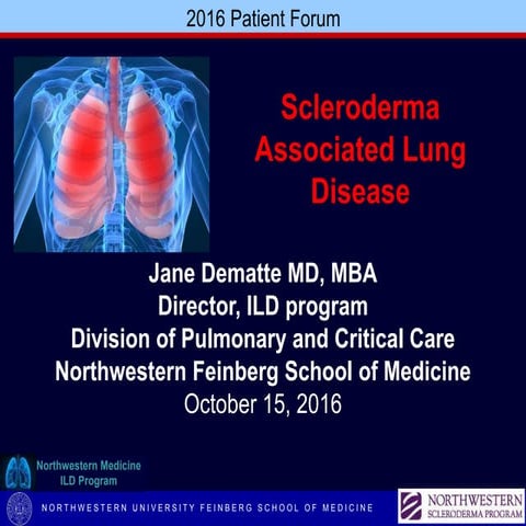 Scleroderma Associated Lung Disease | PPTX