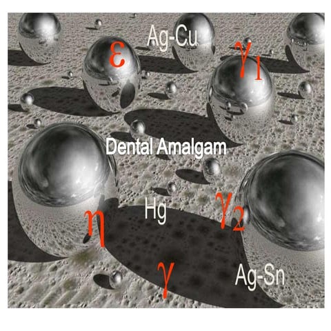 Dental Amalgam (Dental Materials Course) | PDF