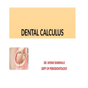 Dental calculus | PPTX