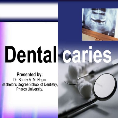 Dental caries | PPT