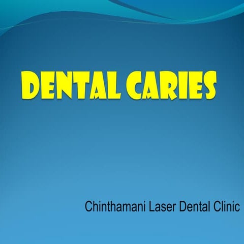 Dental caries | PPT