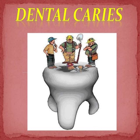 Dental caries | PPT