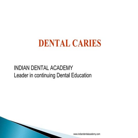 Dental caries 1/ oral surgery courses | PPT
