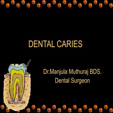 Dental caries | PPT