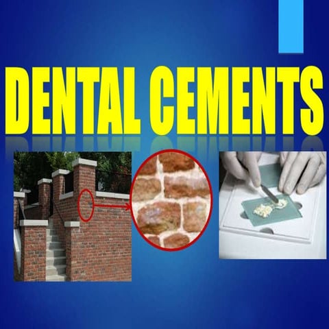 dental cements(1)_ORIGINAL.ppt