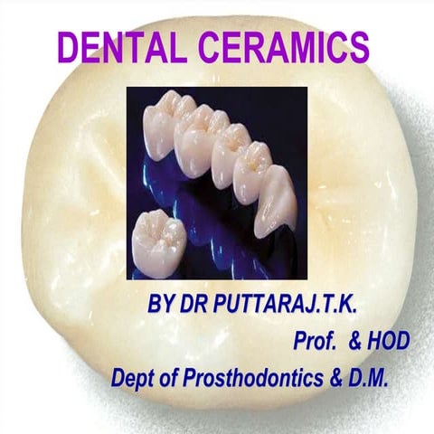 DENTAL CERAMICS (2).ppt