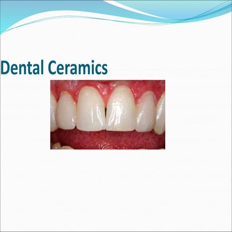 Dental Ceramics types and manufacturing dentistry | PPT