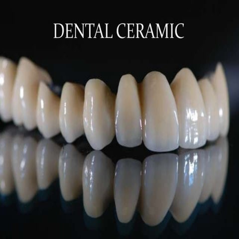 Recent Advances in Dental Ceramics | PPTX