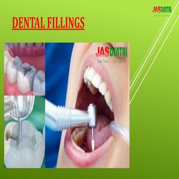 Dental fillings | PPTX