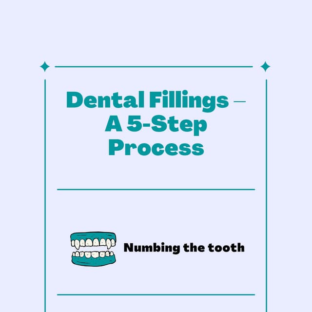 Dental Fillings – A 5-Step Process.pdf