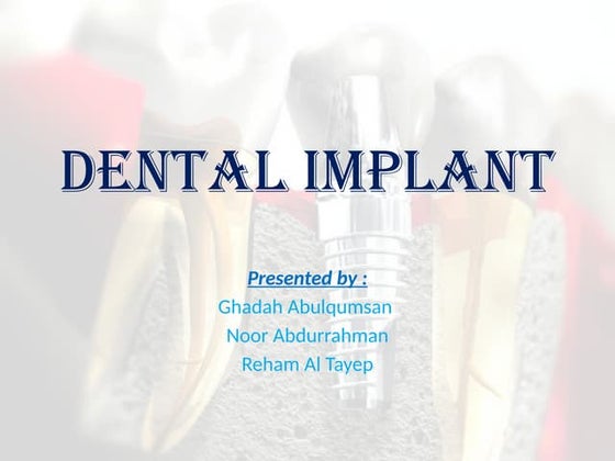 Implant components and function | PPTX
