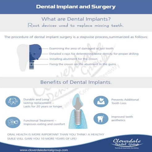 Dental implant and surgery | PDF