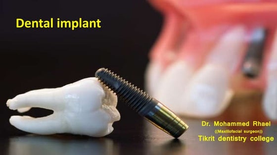Introduction to Dental Implants | PPT