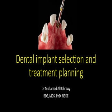 Dental implant selection and treatment planning.pptx