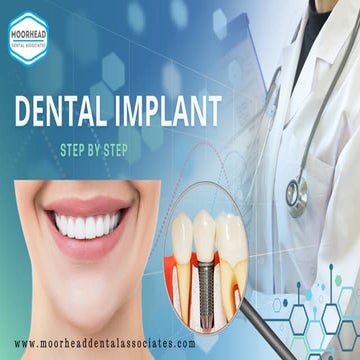 The Dental Implant Procedure: A Step by Step Guide | PDF